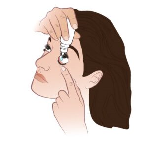 EYE DROPS AND INSTILLATION – Cypress Eye Centre